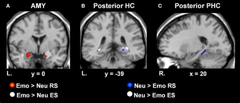 Dissociating Retrieval Processes Linked To The Enhancement Of Emotional