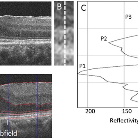 Data Extraction From Grayscale Images A Complete 24 Bit Image Of Download Scientific Diagram