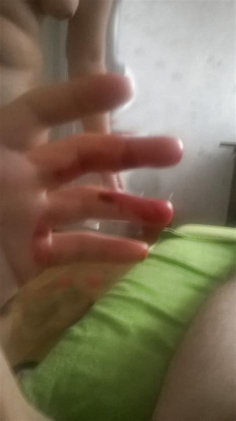 Blood Sugar Sex Magik Porn Pictures Xxx Photos Sex Images 2077351