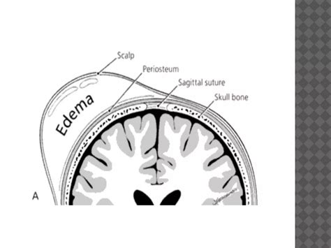 Anatomy Of Scalp Full Detail Pdf