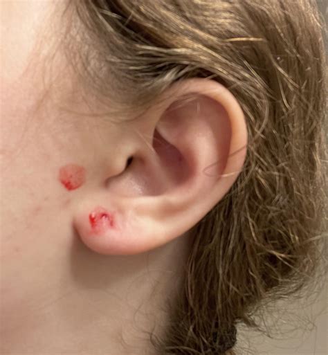 My Earlobe Started Bleeding Randomly Today Is This A Sign From God To