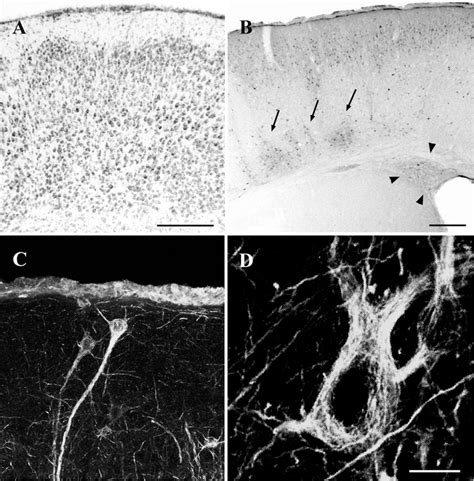 Figure 4 From Expression Of Layer Specific Markers In The Adult
