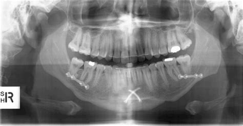 Patient Communication For The Opg Dental Head Start