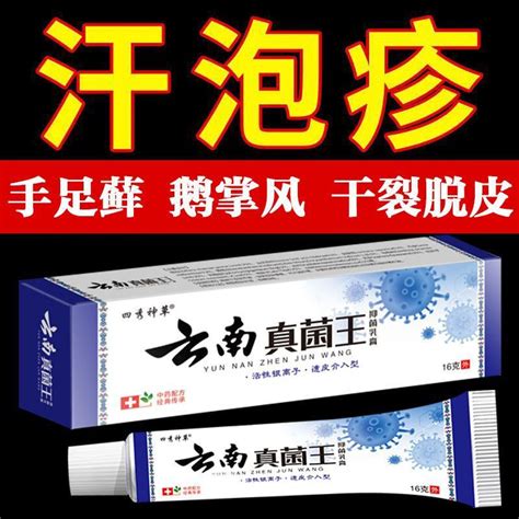 超凡海淘手癬膏手足蘚真菌感染腳氣水泡脫皮乾裂皮膚溼癢止癢膏鵝掌風乳膏 蝦皮購物