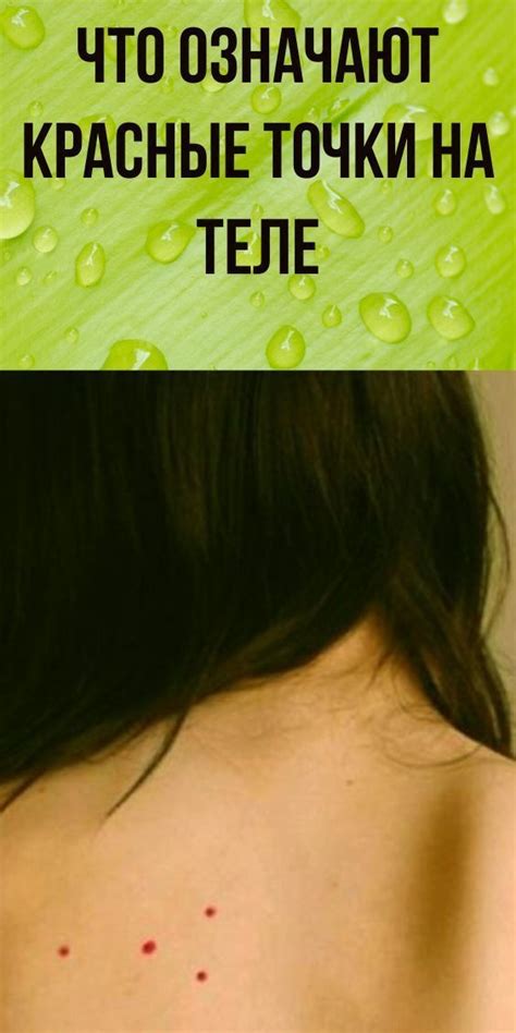 Что означают красные точки на теле Красные точки Здоровье Здоровые органы