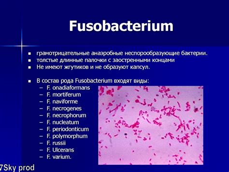 Group A Streptococcus Antibiotic Treatment