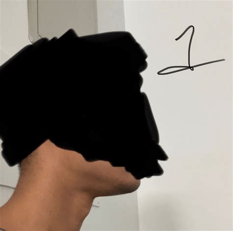 Bulge While Mewing R Mewing