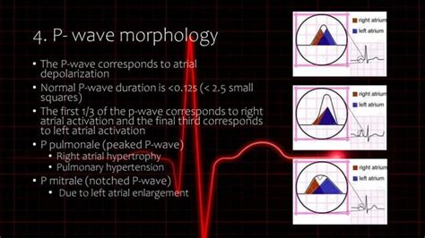 Basic Ecg Interpretation Pptx Heart And Cardiovascular Diseases Diseases And Conditions