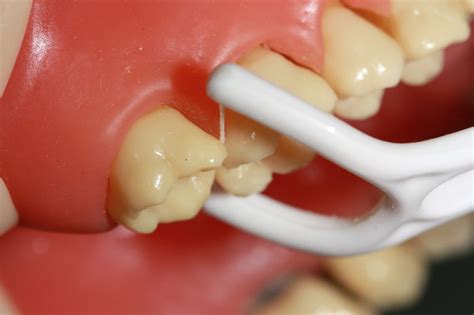 Is Using A Floss Pick As Good As Regular Flossing David J Rossen DDS Floss Picks