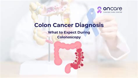 Colon Cancer Diagnosis How To Prepare For A Colonoscopy Process