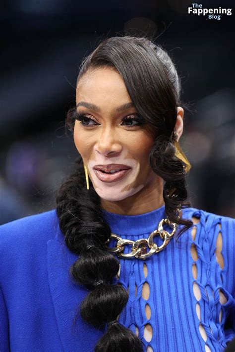 Winnie Harlow Sexy 46 Photos The Fappening Plus