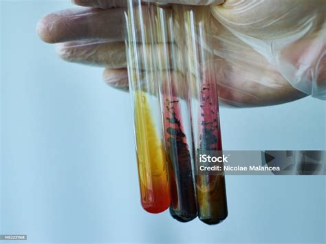 다양한 박테리아 배양 배지 시험관 미생물학 실험실 테스트 Stem 주제에 대한 스톡 사진 및 기타 이미지 Stem 주제