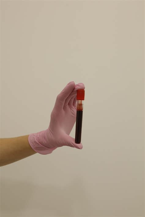 Elevated Bnp Levels Explained Dawn Christine Simmons