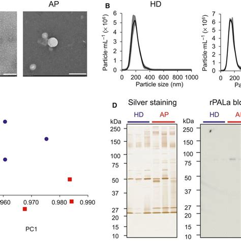 Glycan Profiling Of Evs Derived From Sera Of Hds And Aps A Download Scientific Diagram