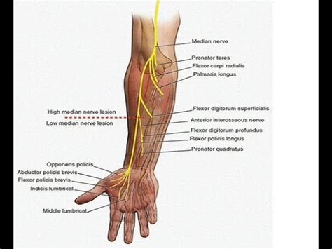 Anatomy Median Nerve