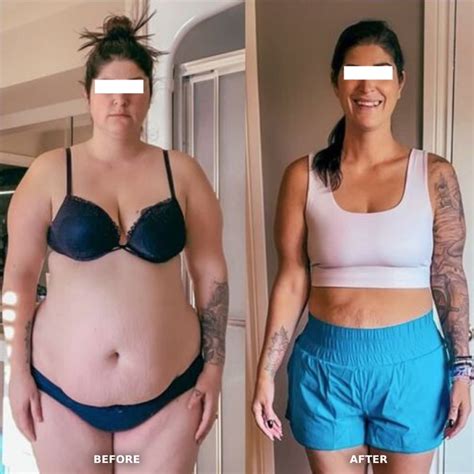 Glp 1 Weight Loss Injections In Naperville Il