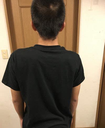 肩の左右差が出やすいスポーツ原因と影響対策法は 姿勢の専門家のブログ Produced by 宮前まちの整骨院
