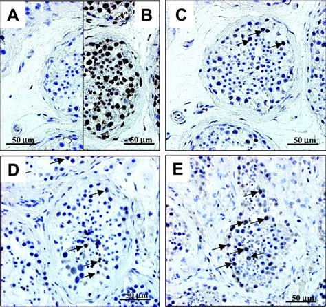 Dna Fragmentation In Testis Explants As Revealed By The Terminal Download Scientific Diagram