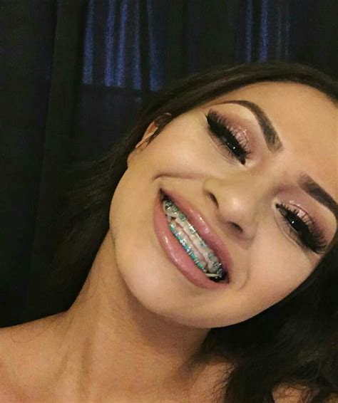 Pinterest Miryan♓ Braces Colors Cute Braces Cute Braces Colors
