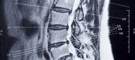 How Long Do ARRT Credentials Take How Long Do ARRT Credentials Take