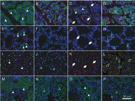 Double Staining Of Paraffin Embedded Sections Of Organs Sampled From