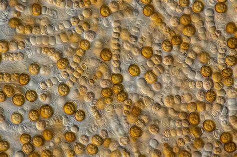 Anabaena Sp Algae Light Micrograph Stock Image C056 8861 Science Photo Library