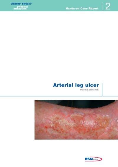 Arterial Leg Ulcer Cutimed