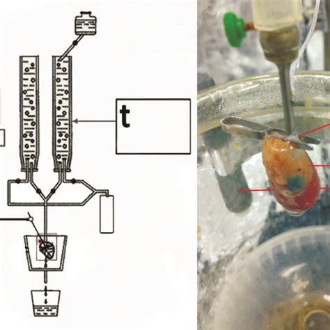 Perfusion Of The Isolated Rat Heart According To Langendorff Technique Download Scientific