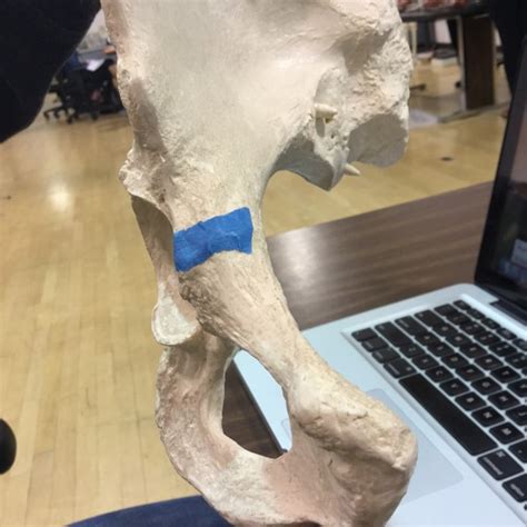 Appendicular Skeleton Part Iv Pubis Anterior Flashcards Quizlet