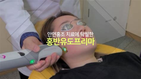 안면홍조 없애는법 홍반유도프리마 브이빔프리마 Youtube