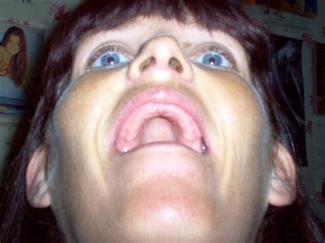 Dentures Out By Denturelover On Deviantart