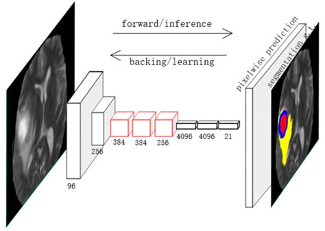 A Review Of Deep Learning Based Medical Image Segmentation Methods