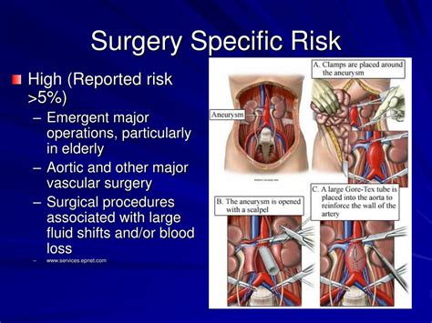 Surgical Risk Procedure Type Classification Of Surgery According To Risk Ydfqn