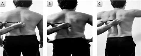 Lateral Scapula Slide Measurement A The First Position With Arms At Download Scientific
