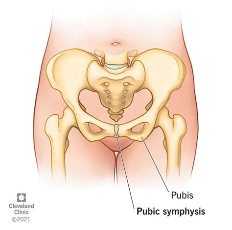 Pubic Symphysis Causes Symptoms Treatment Healthy Food Near Me