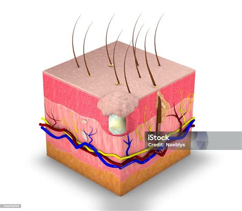 Sebaceous Cyst Diagram