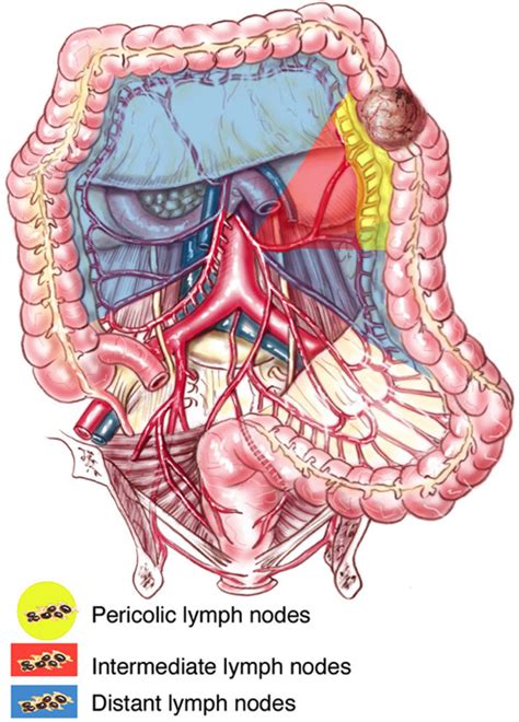 Hepatic Flexure Of Colon
