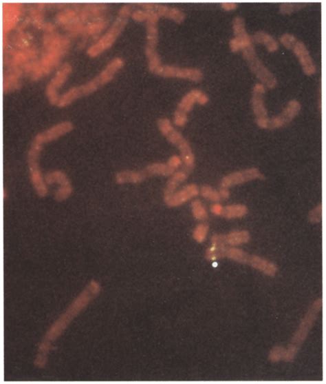 In Situ Hybridization Of Biotin Labeled Polymerase Chain Reaction Pcr