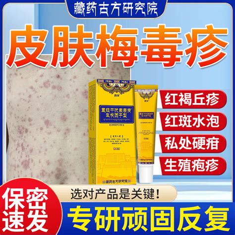 浑身红斑皮肤发痒第5页大山谷图库