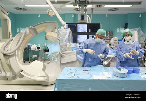 Cerebral Aneurysm Embolization Angiography System Interventional Neuroradiology Radiology