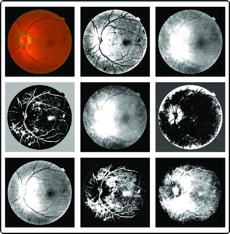 Feature Map Of The First Convolutional Layer On Messidor Dataset We Download Scientific
