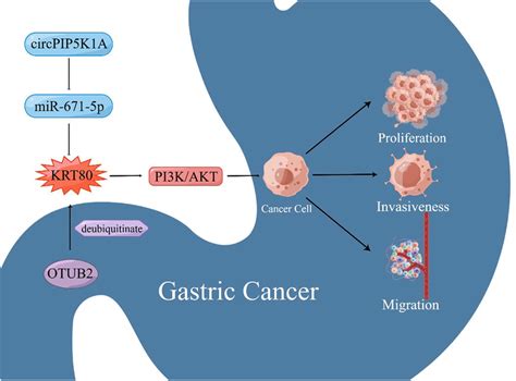 The Roles Of Krt80 In Gastric Cancer Download Scientific Diagram