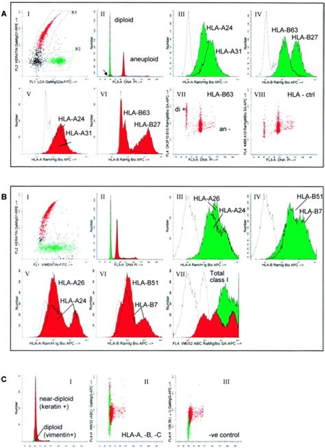 Examples Of Altered Hla A B Phenotypes In Cervical Cancer Cell