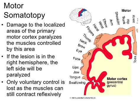Premotor Cortex Lesion Body Pathology Rejazcastle
