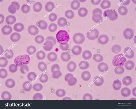 2238 Imágenes De Plasmodium Malaria Imágenes Fotos Y Vectores De Stock Shutterstock