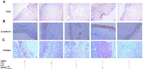 Runx2 Improves Neovascularization And Re Epithelialization Of Burn Skin