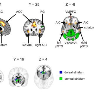 Regions Activated By An F Test Over The 24 Trials From The Averaged Download Scientific