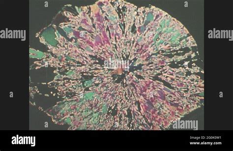 Sagittal Slice Stock Videos And Footage Hd And 4k Video Clips Alamy