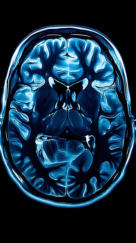 Mri Scan Of A Human Brain Highlighting Anatomical Structures In A Clinical Setting Premium Ai