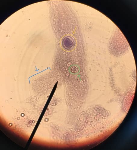 Protista Flashcards Quizlet